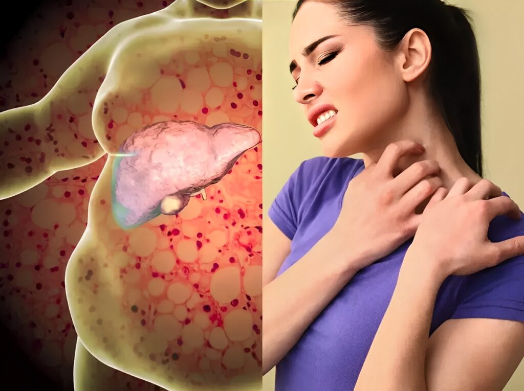 Negeer de signalen van een vervette lever niet! Zo herken je het ...