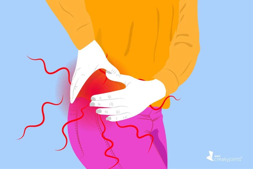 Let op! Deze symptomen wijzen op een versleten heup – Menszine